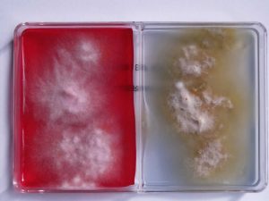 When do we have to perform a Fungal Culture?