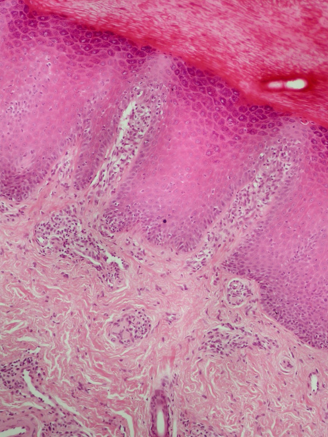 Pododermatitis – A Common Problem With Many Causes