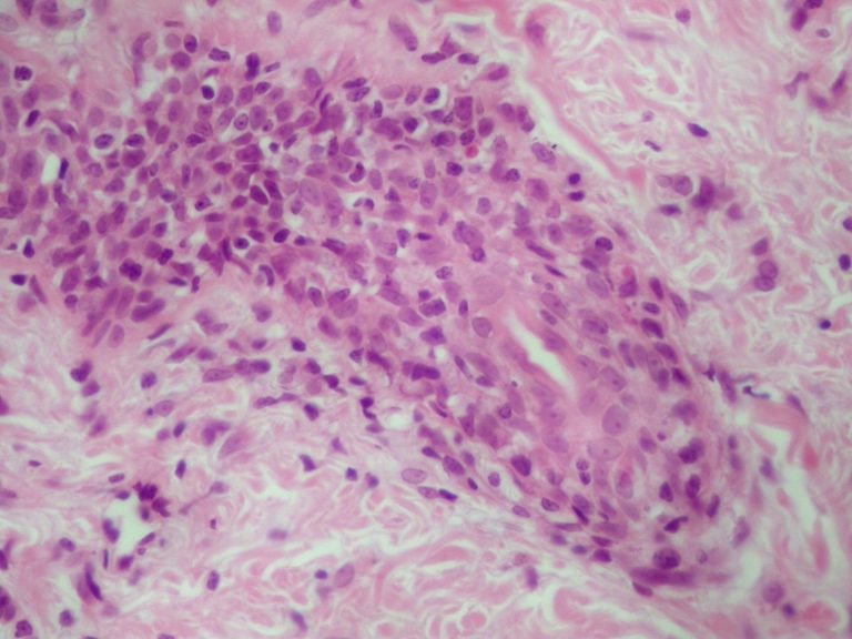 Pododermatitis – A Common Problem With Many Causes